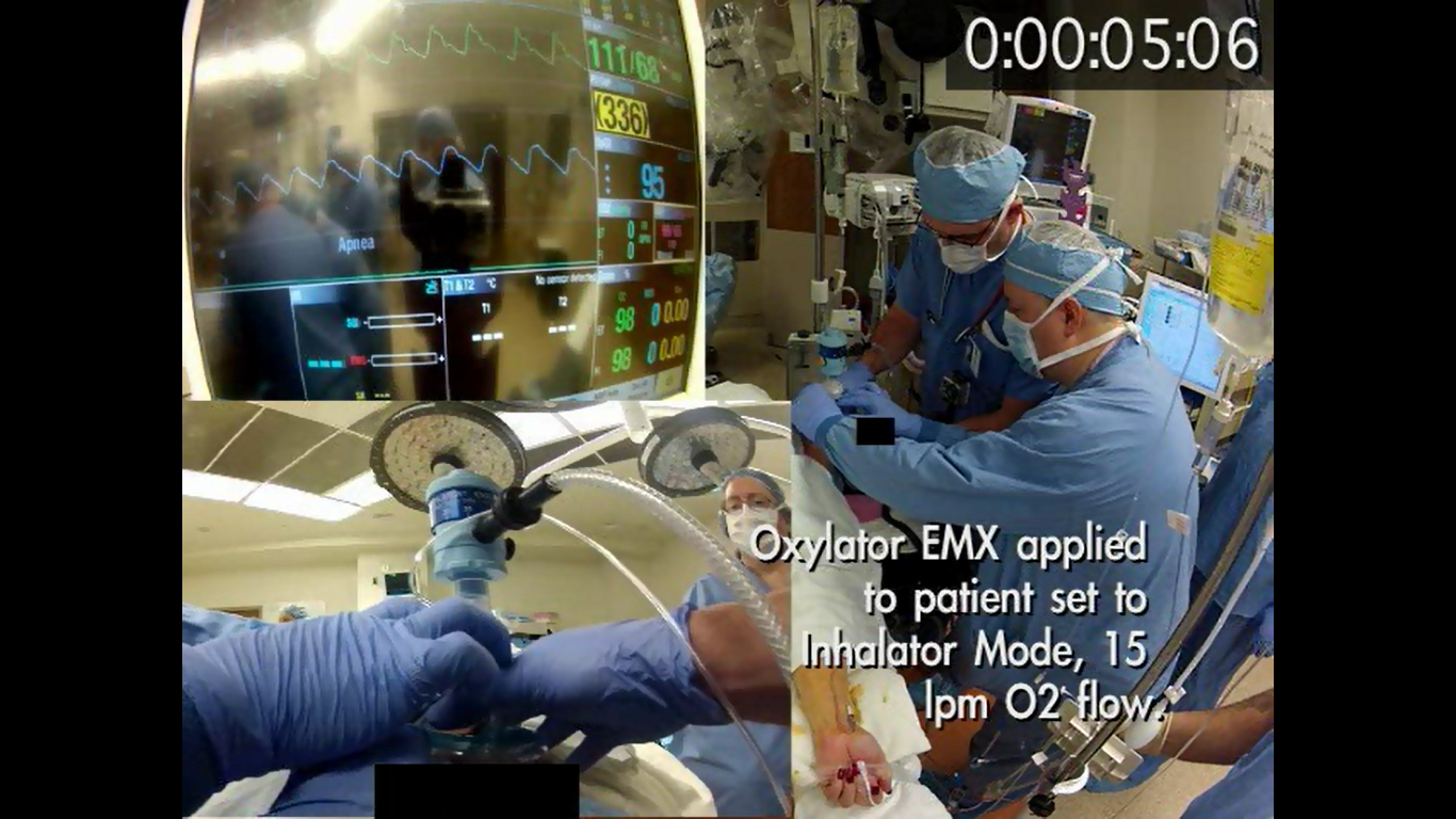 Oxylator and McGrath Video intubation in firefighter training ...