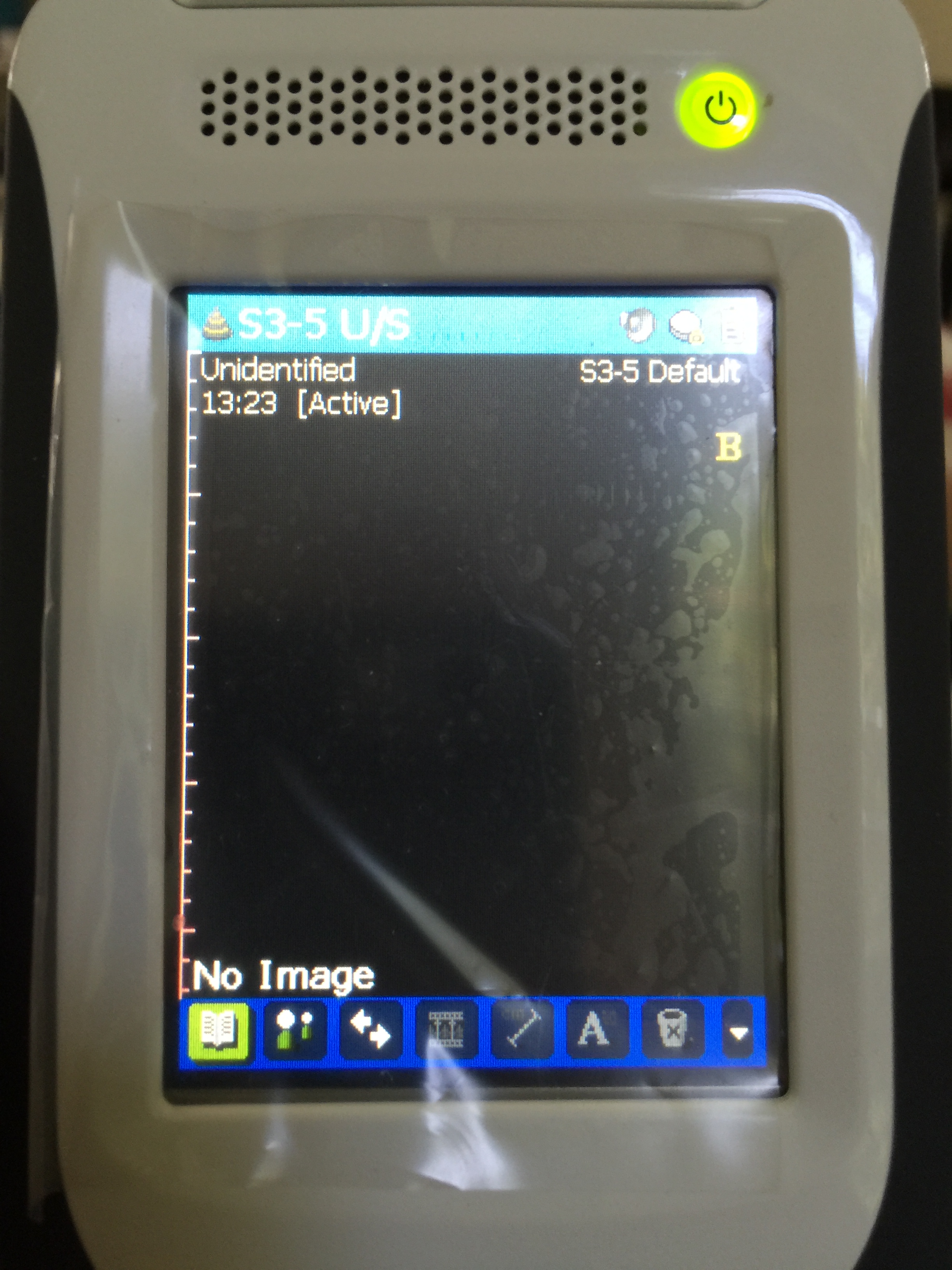 Signostics RT handheld ultrasound review – Prehospital and Retrieval ...