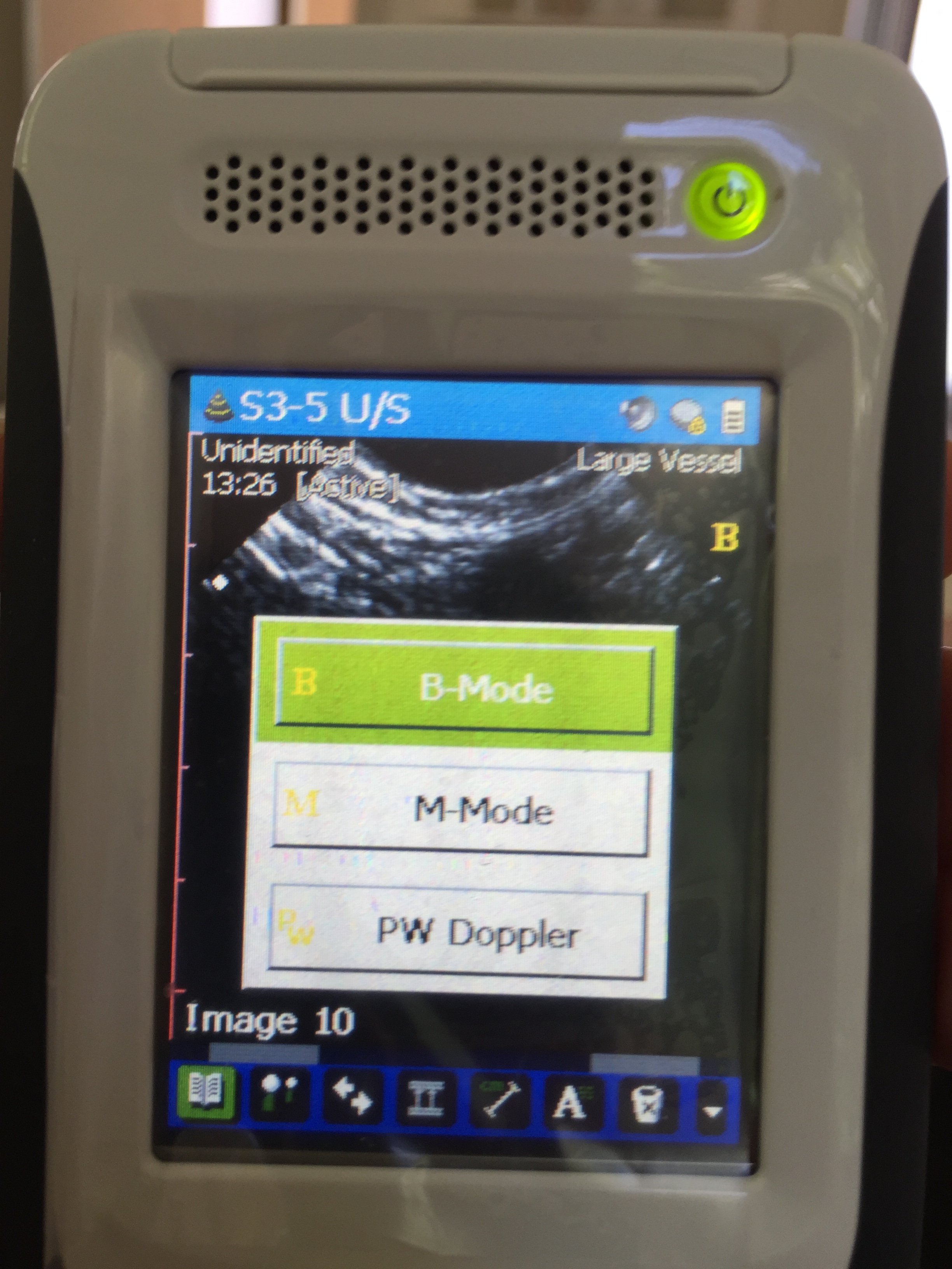Signostics RT handheld ultrasound review – Prehospital and Retrieval ...